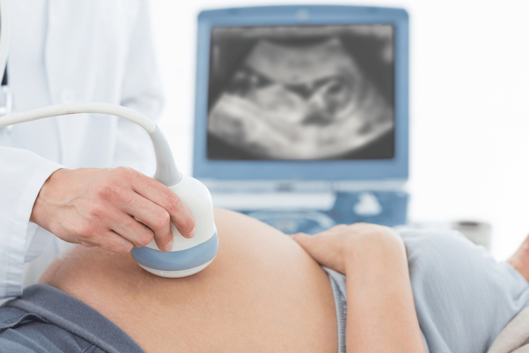 A new prenatal screening test is dominating the market but questions ...